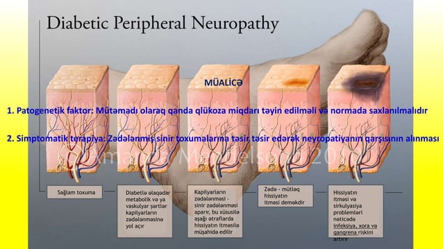Diabetic neuropathy treatment methods | PPTX
