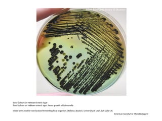 Hectoen Enteric Agar for Enteric Bacterial Culture | PPTX