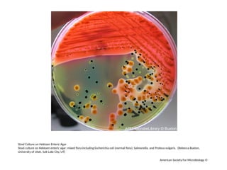 Hectoen Enteric Agar for Enteric Bacterial Culture | PPTX