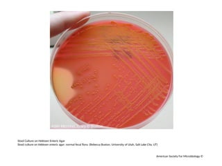 Hectoen Enteric Agar for Enteric Bacterial Culture | PPTX