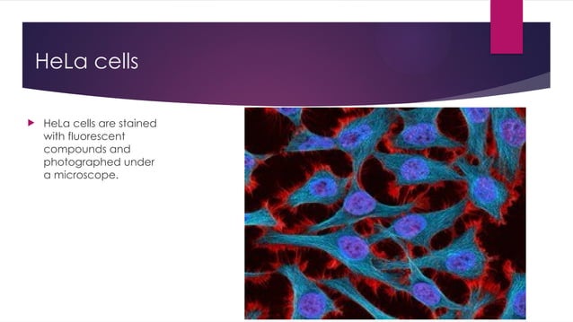 HeLa cell line their features and all the important information | PPT