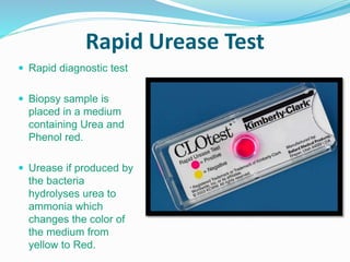 Helicobacter pylori | PPTX