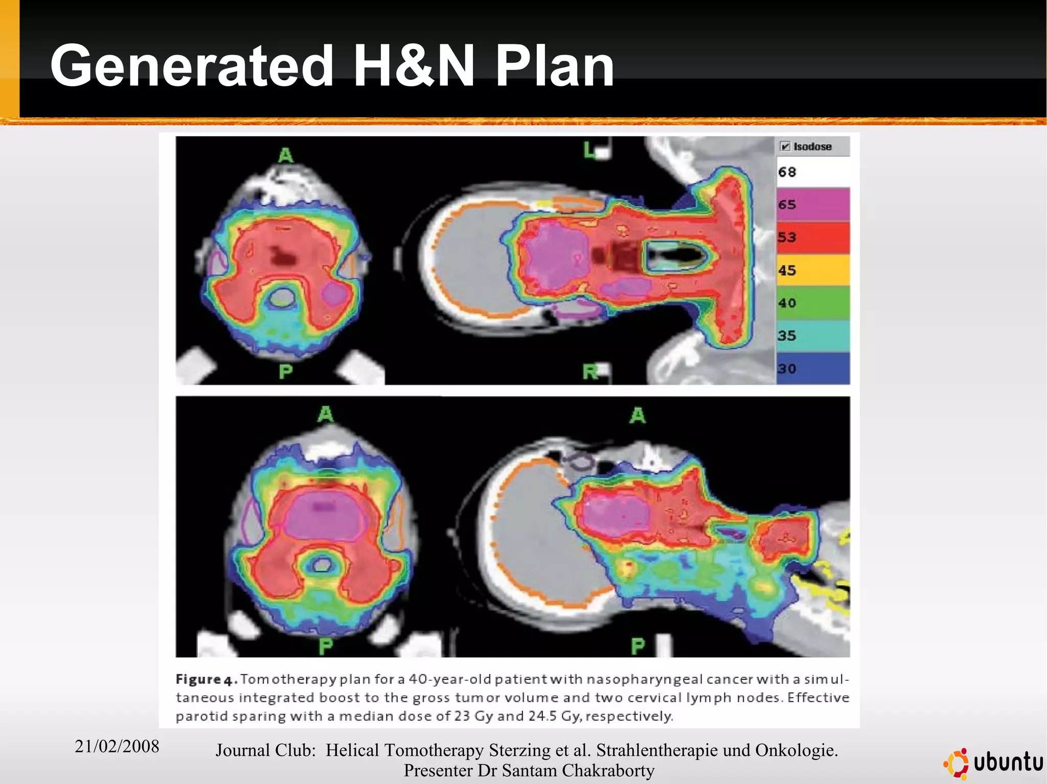 Helical Tomotherapy | ODP