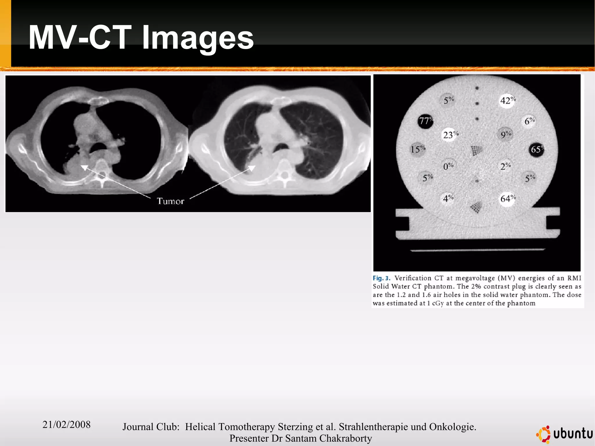 Helical Tomotherapy | ODP