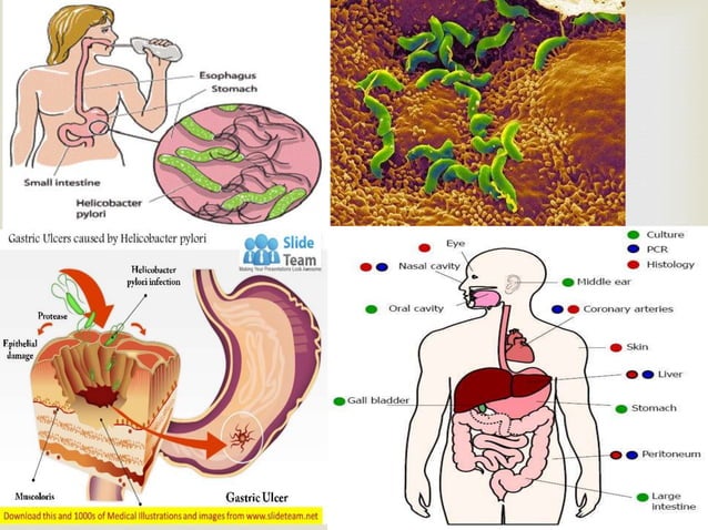 Helicobacter | PPT