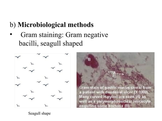 HELICOBACTER PYLORI by Dr Teena Varghese. pptx | PPT