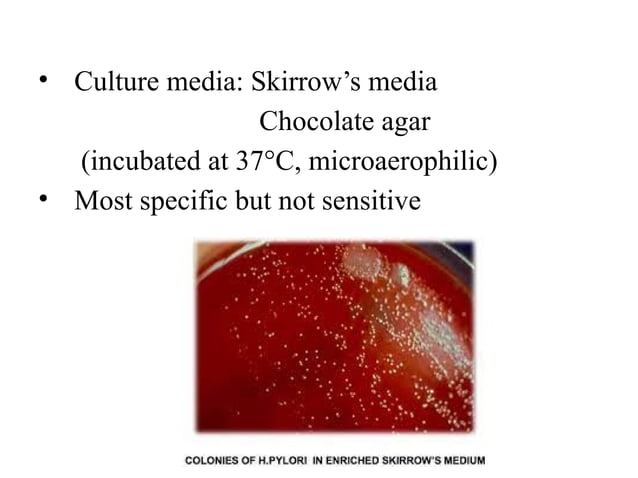 HELICOBACTER PYLORI by Dr Teena Varghese. pptx | PPT