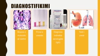 Helicobacter Pylori | PPT