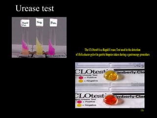 Helicobacter & campylobacter lec.11 dr.ihsan alsaimary | PPT