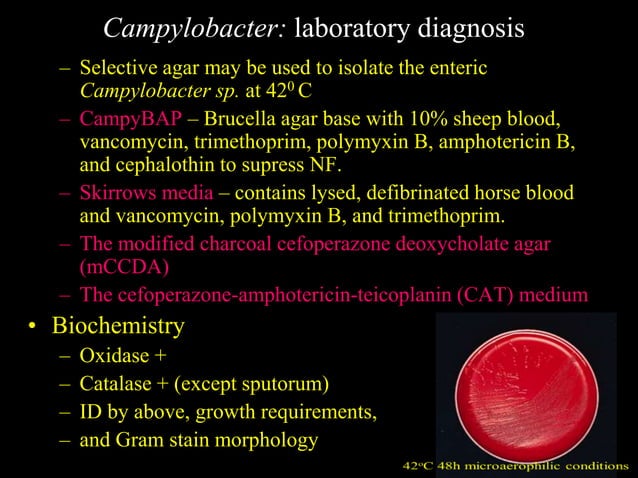 Helicobacter & campylobacter lec.11 dr.ihsan alsaimary | PPT