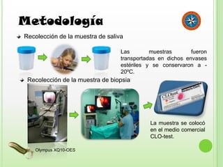 Helicobacter pylori (IgAs y test de ureasa) | PPTX