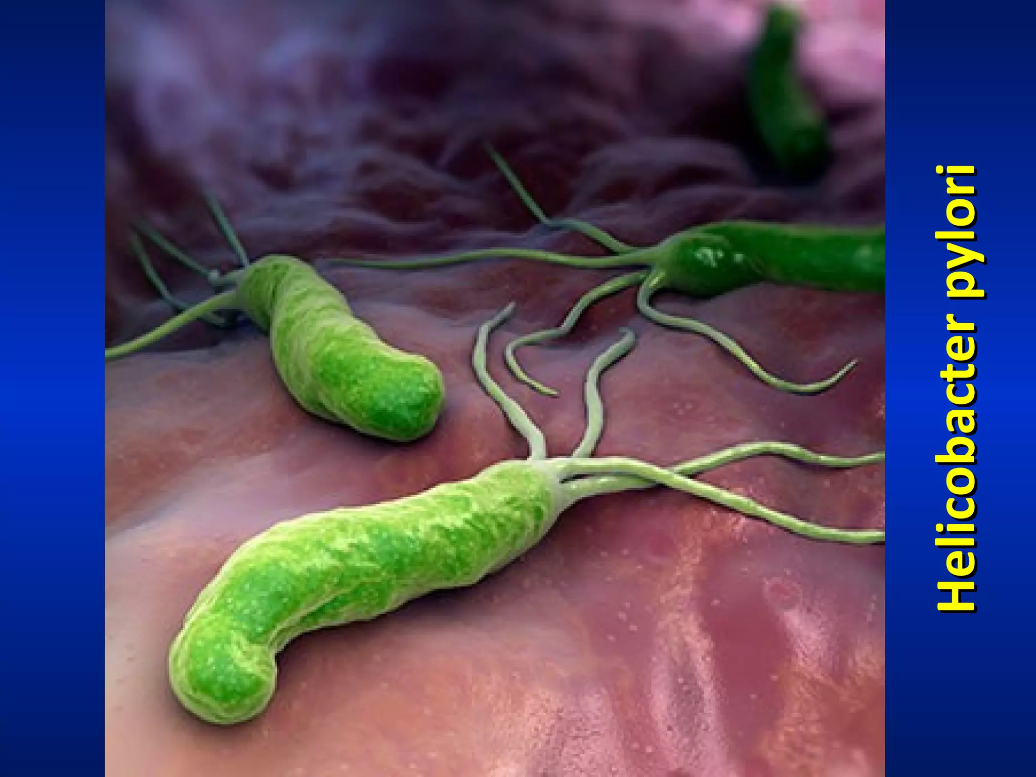 Helicobacter pylori | PPT