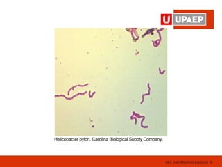 Helicobacter pylori | PPTX