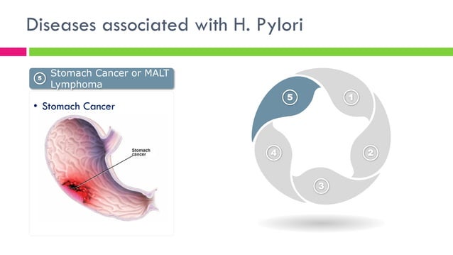 Helicobacter pylori | PDF