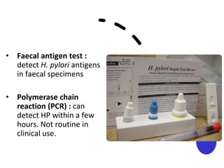 Helicobacter pylori .pptx