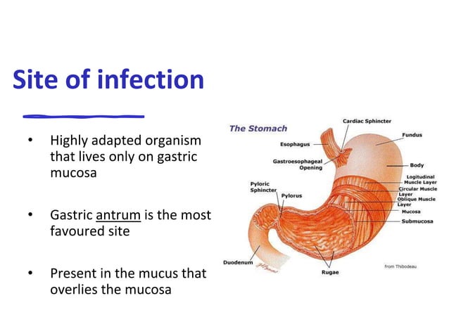 Helicobacter pylori .pptx