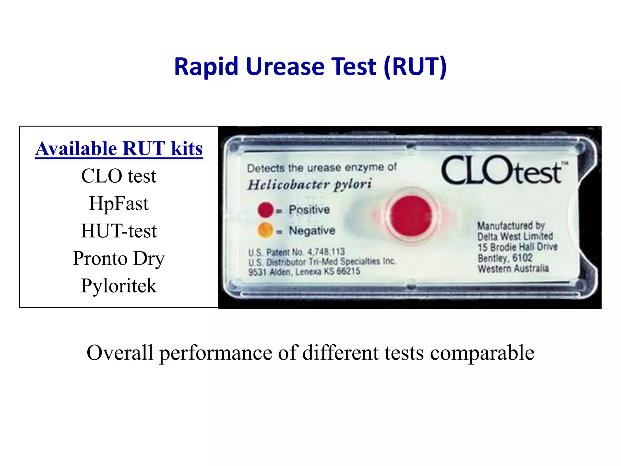 Helicobacter pylori infection | PPTX