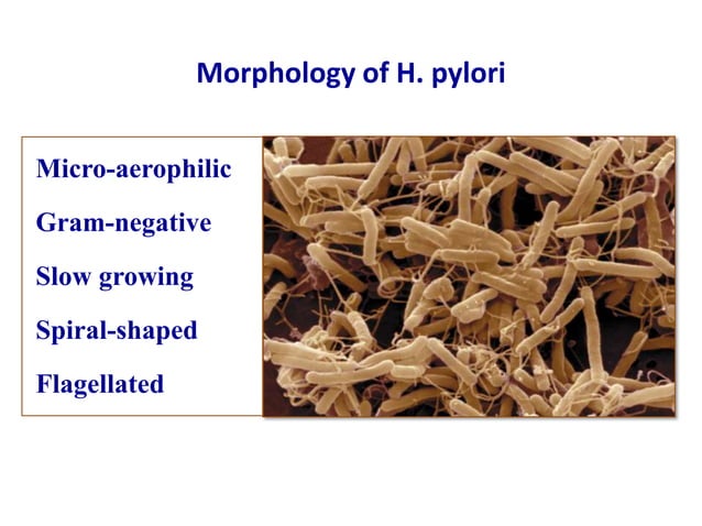 Helicobacter pylori infection | PPTX