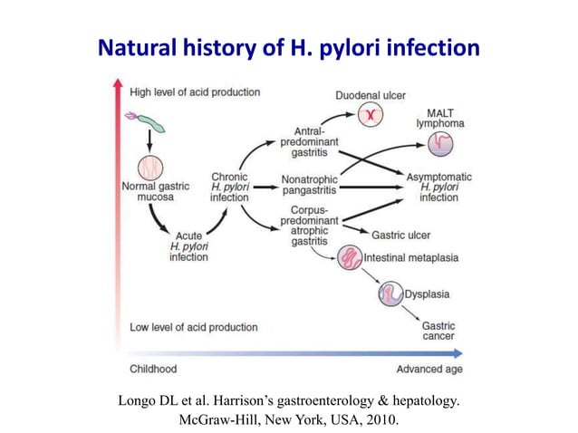 Helicobacter pylori infection | PPTX
