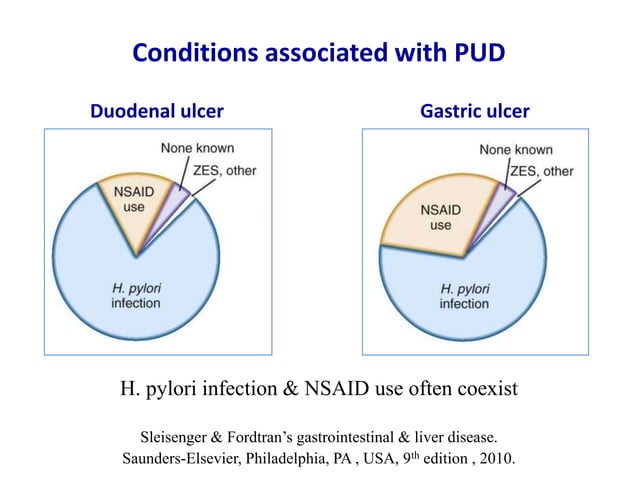 Helicobacter pylori infection | PPTX