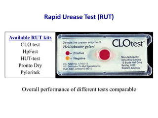Helicobacter Pylori Urease For Diagnosis Of Helicobacter, 43% OFF