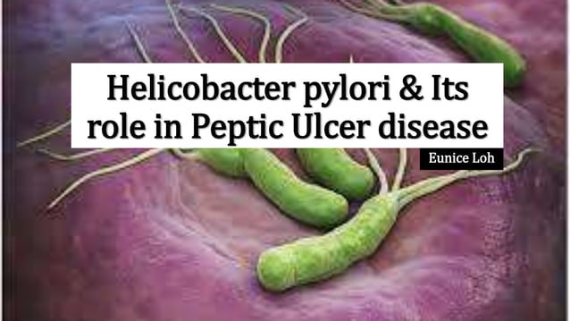 Helicobacter pylori & Its role in Peptic Ulcer.pptx | Medical Health