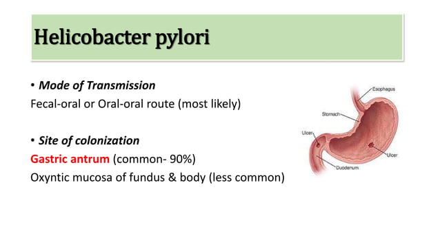 Helicobacter pylori & Its role in Peptic Ulcer.pptx | Medical Health