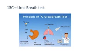 Helicobacter pylori & Its role in Peptic Ulcer.pptx | Medical Health