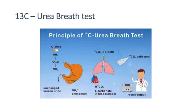 Helicobacter pylori & Its role in Peptic Ulcer.pptx | Medical Health