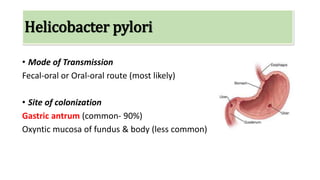 Helicobacter pylori & Its role in Peptic Ulcer.pptx