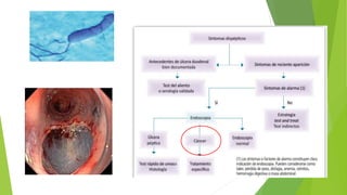 Helicobacter pylori moduladora del sistema inmune en alergias