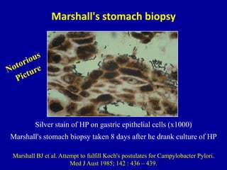 Helicobacter pylori & Nobel Prize in medicine & physiology | PPT