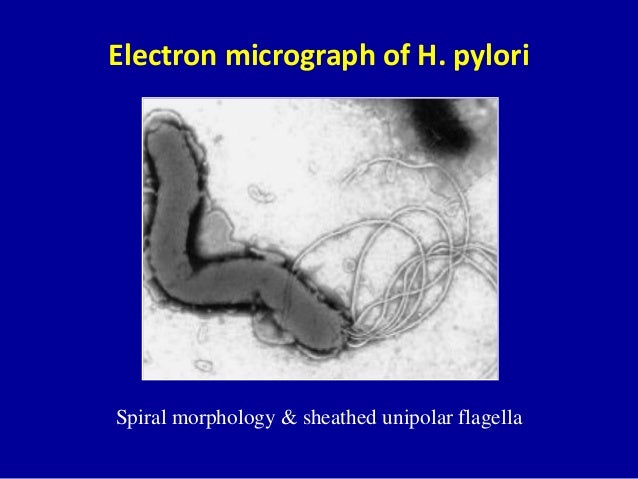 Helicobacter pylori & Nobel Prize in medicine & physiology