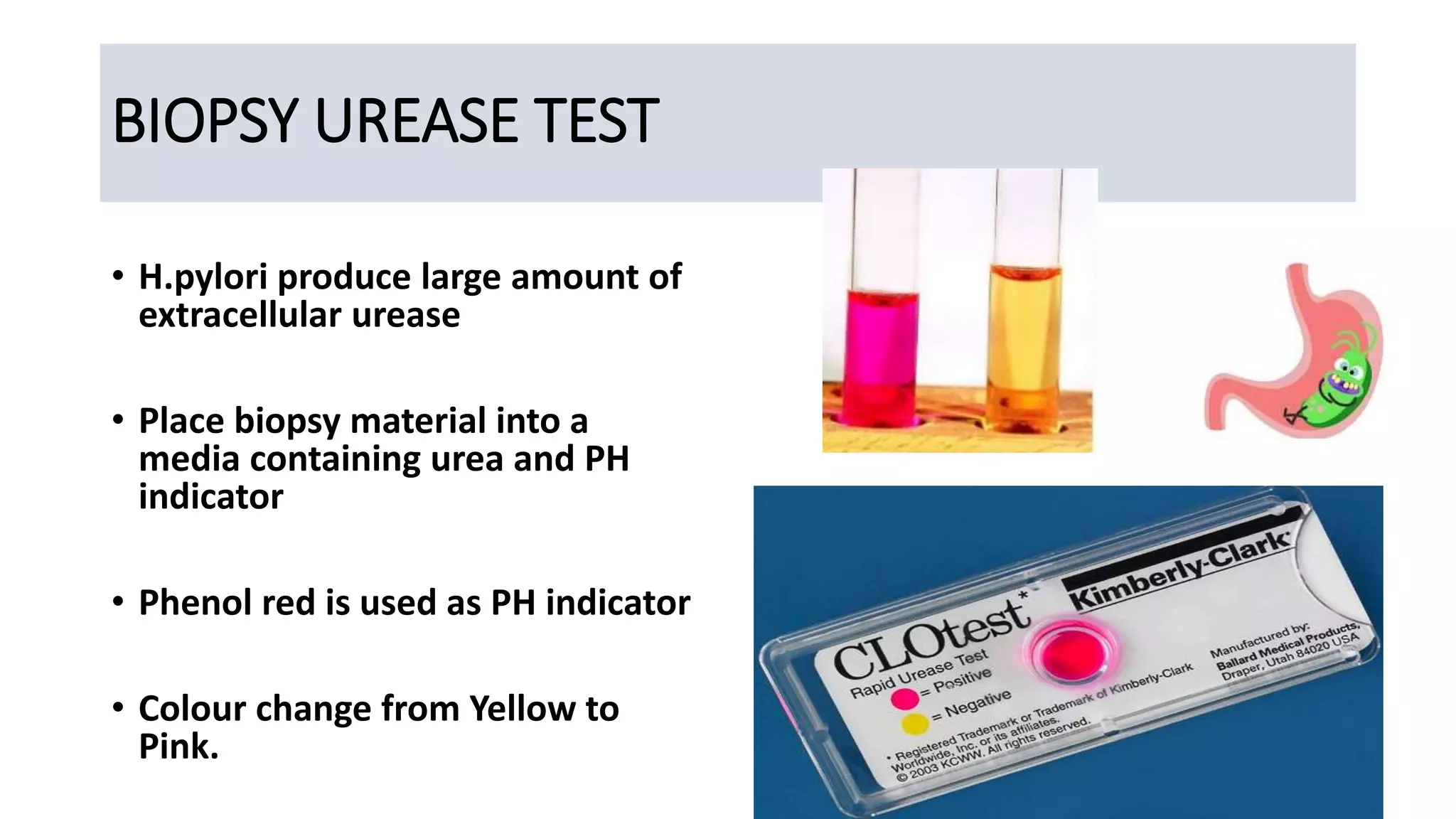 Helicobactor pylori | PPTX