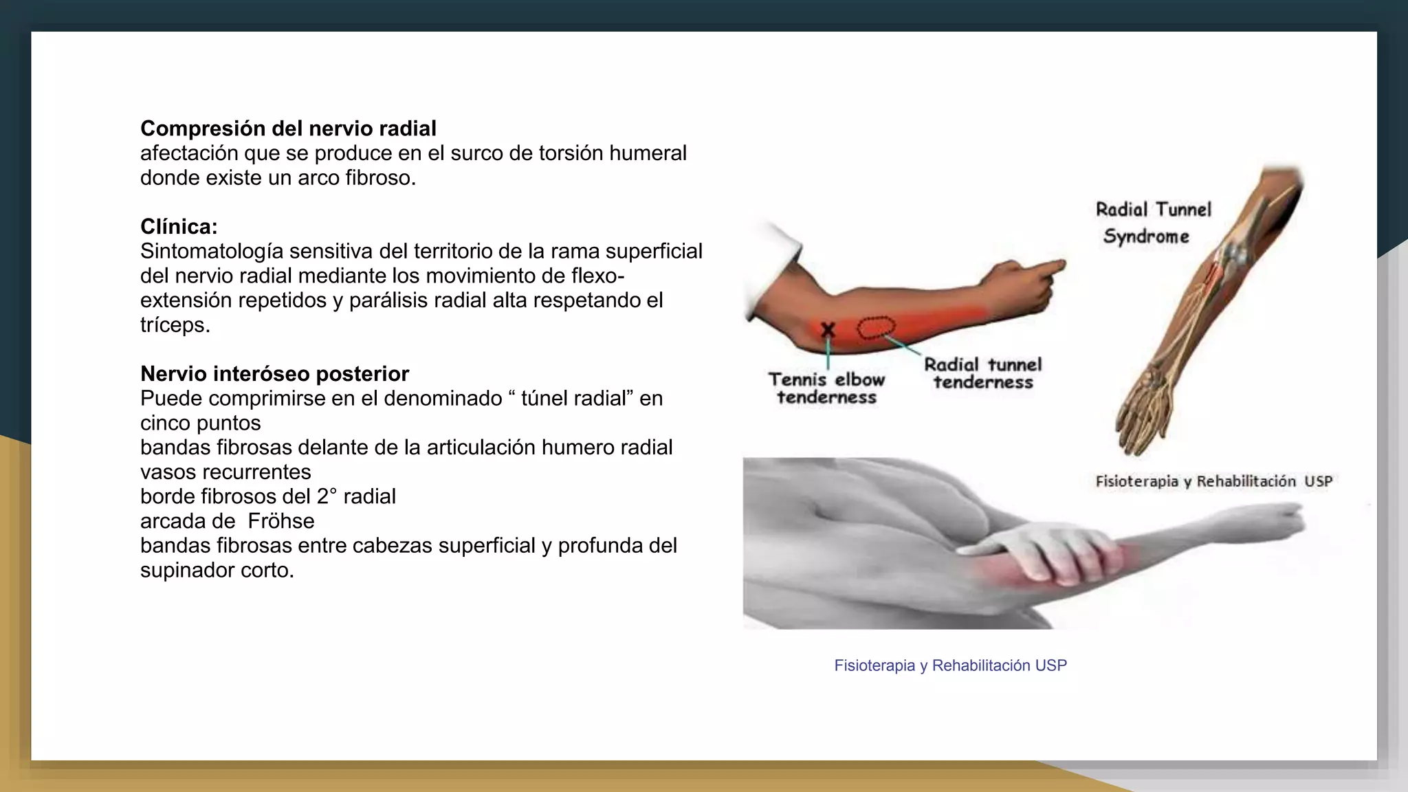 MENISCO ANATOMIA | PPTX