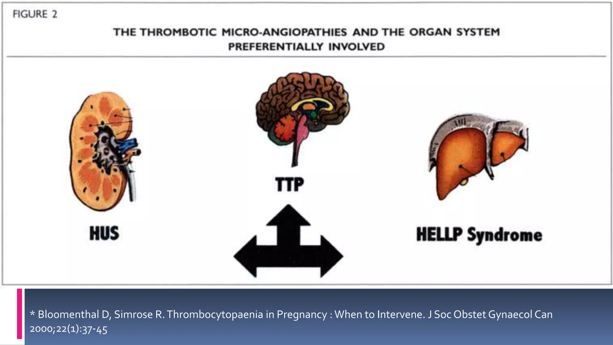 HELLP SYNDROME | PPTX