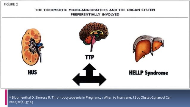 HELLP SYNDROME | PPTX