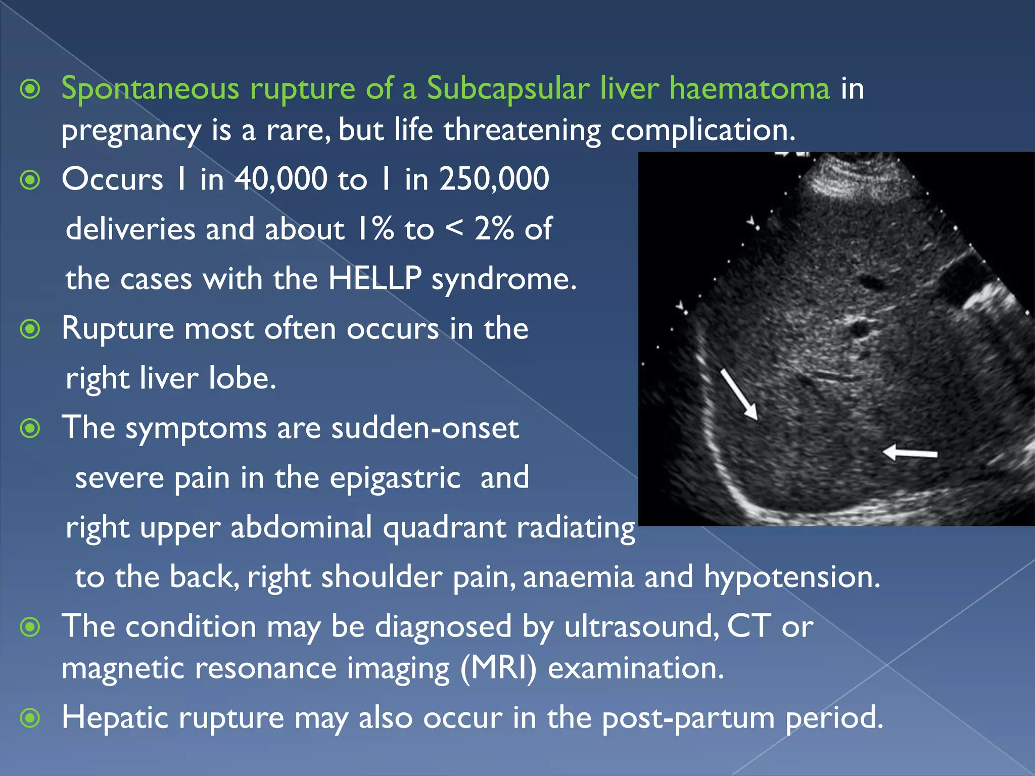 Hellp syndrome | PPTX