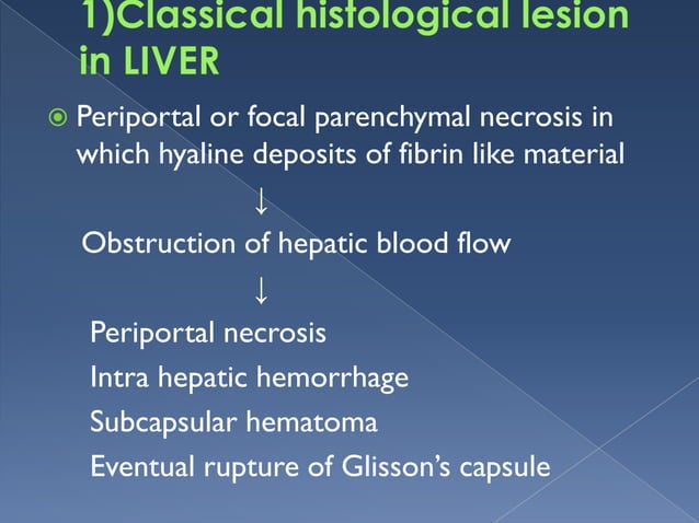 Hellp syndrome | PPTX