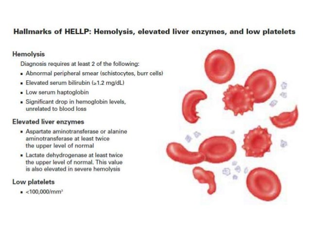 Hellp syndrome