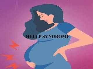 HELLP SYNDROME-RARE COMPLICATION OF PREGNANCY | PPTX