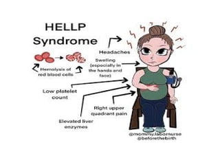 HELLP SYNDROME-RARE COMPLICATION OF PREGNANCY | PPTX