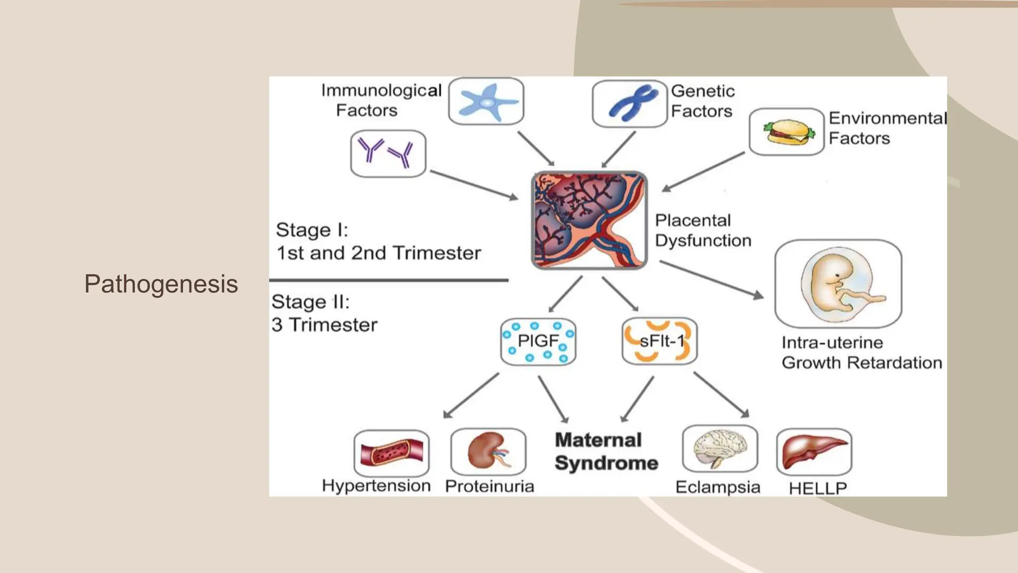 HELLP Syndrome Powerpoint from the perspective of obgyn | PDF