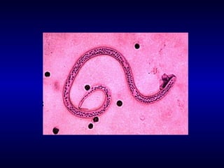 medical Helminthology, parasitic worms .ppt