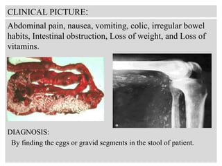 Short Overview of HELMINTHS(Microbiology) | PPTX