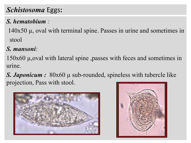 Short Overview of HELMINTHS(Microbiology) | PPT