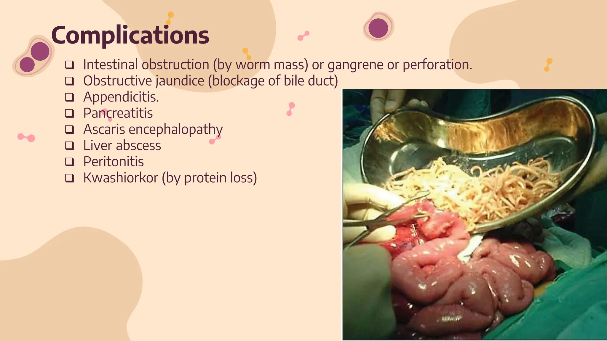 Helminthiasis or Worm infestation in Children for Nursing students | PPTX