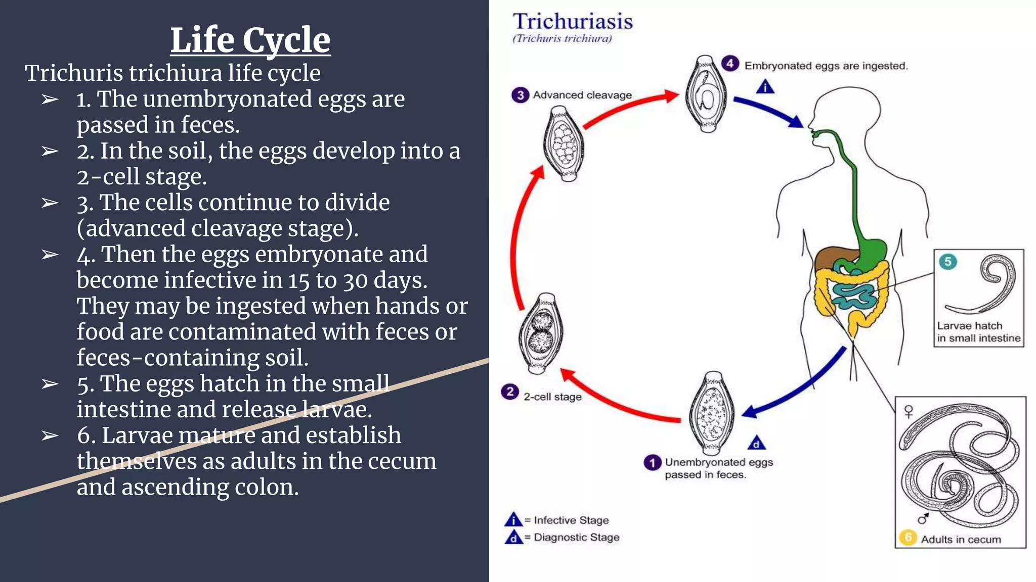 Helminthiasis- Trichuriasis | PPTX