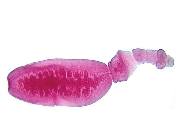 These are helminth slides for practical learning purpose | PPT