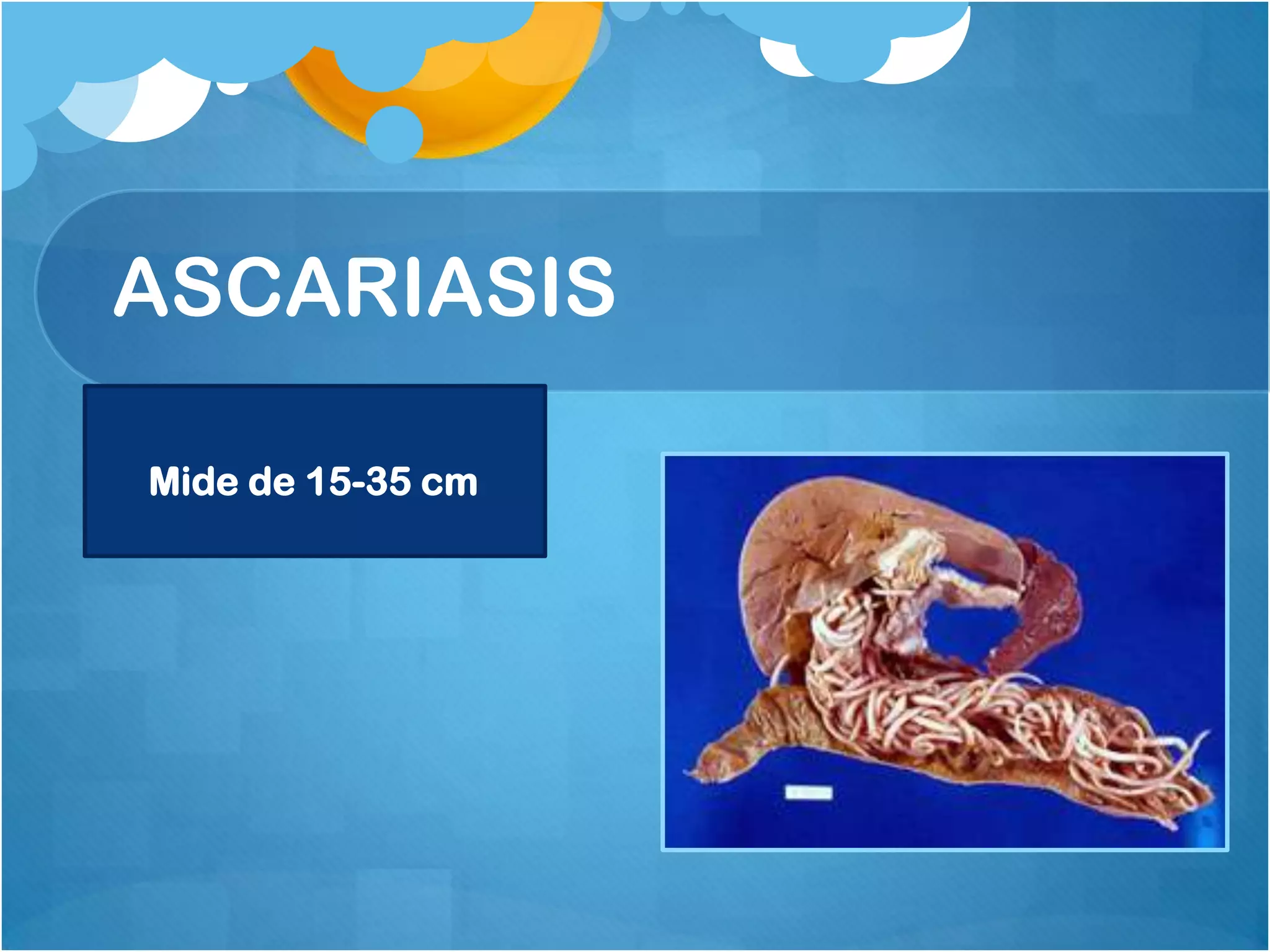 parasitosis tratamientos helmintiasis y protozoos | PPT